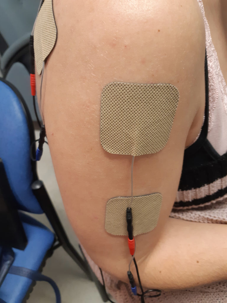 TENS en pratique - SFETD - Site web de la Société Française d'Etude et ...